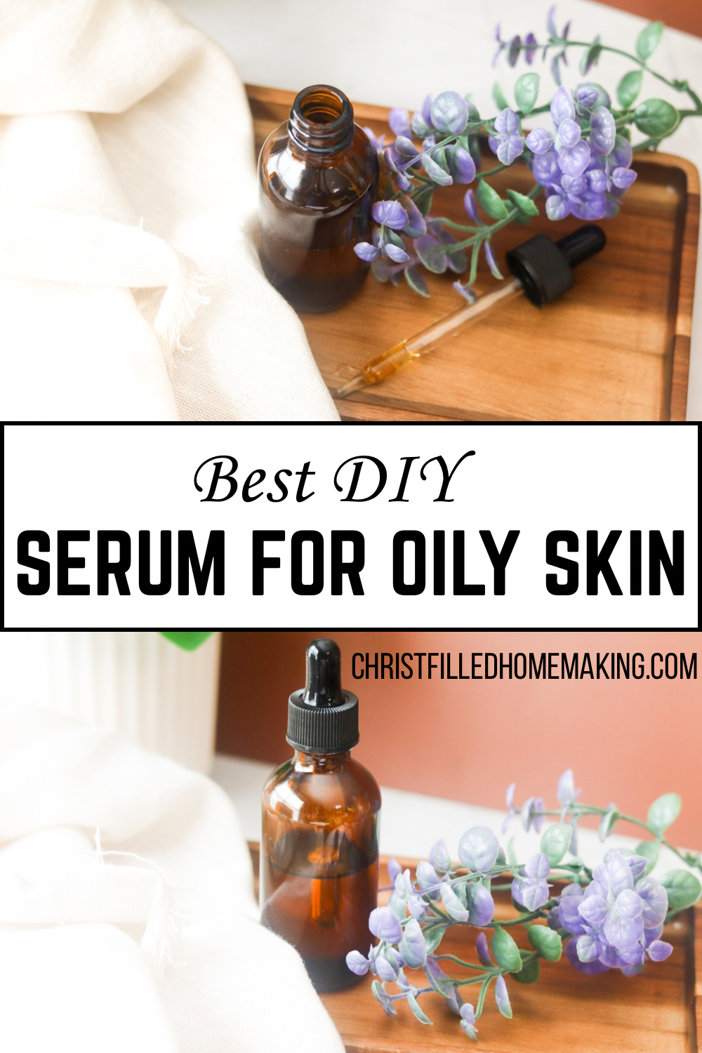 Best Serum for Oily Skin – DIY Easy Recipe